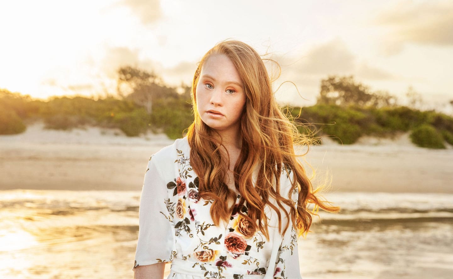 Celebrities with Down Syndrome - Maple Services